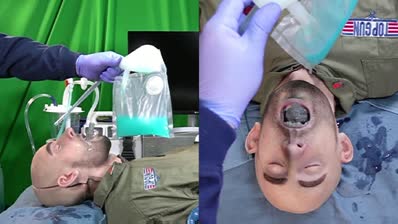 introduction-to-the-seaduc-and-suction-assisted-igel-insertion-3-mp4 ...