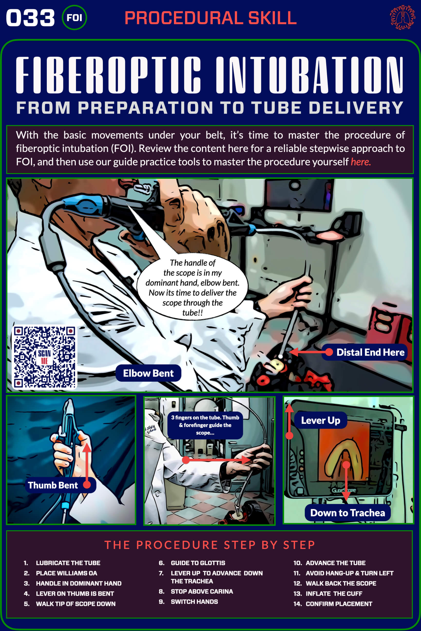Fiberoptic Intubation Technique – The Protected Airway Collaborative