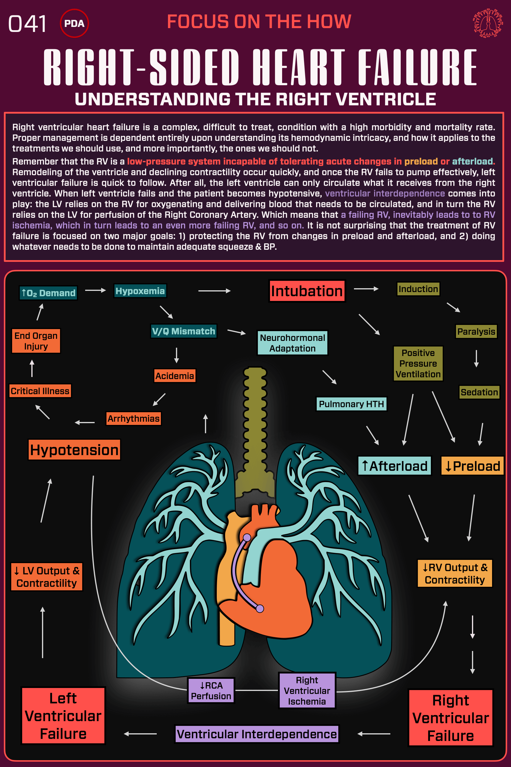 Right Sided Heart Failure