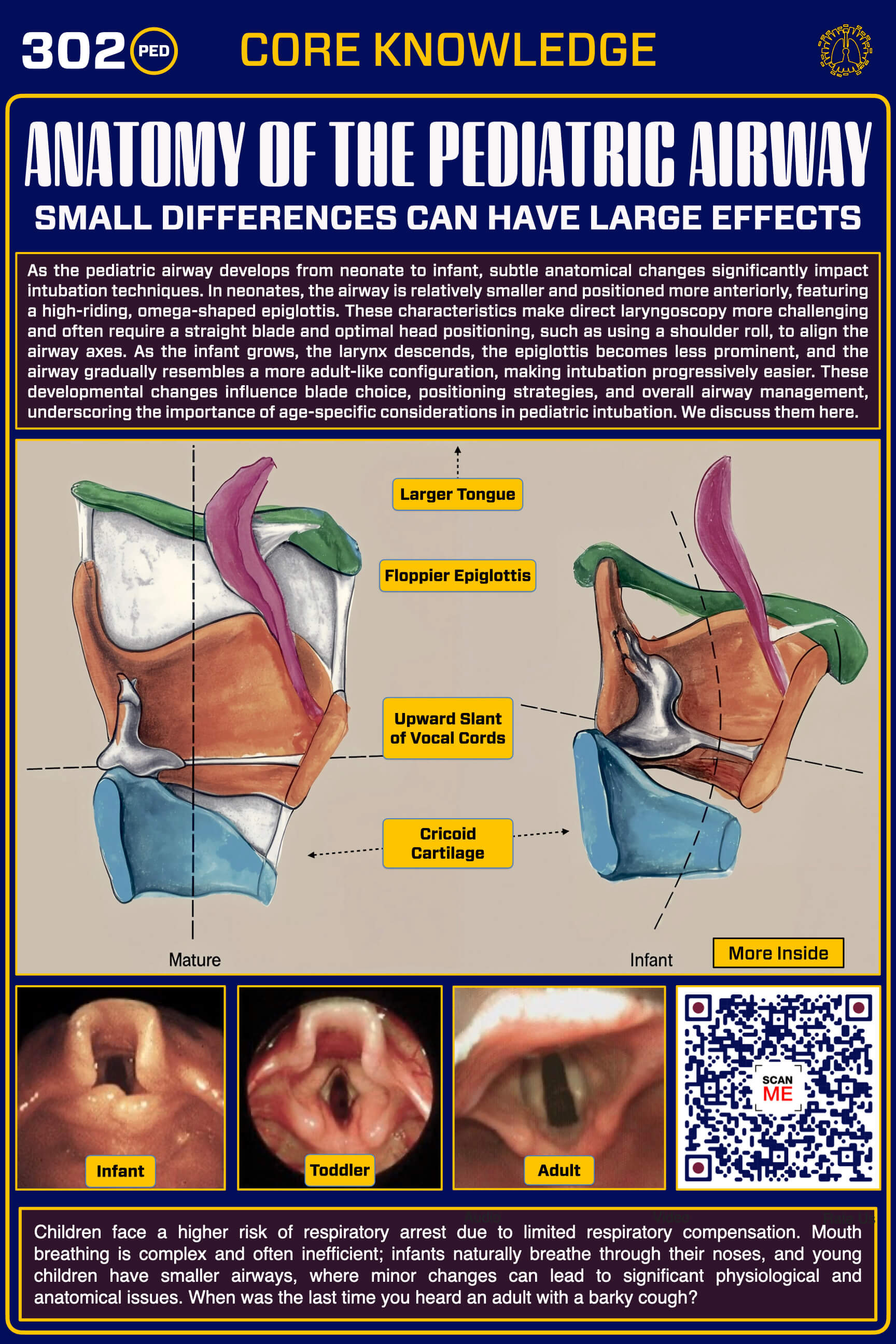 Anatomy of the Pediatric Airway – The Protected Airway Collaborative