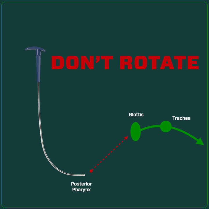 The Rigid Stylet – The Protected Airway Collaborative